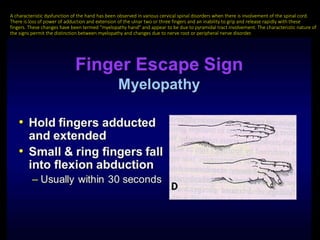 Lecture cervical pediculolysis 2021 april | PPT