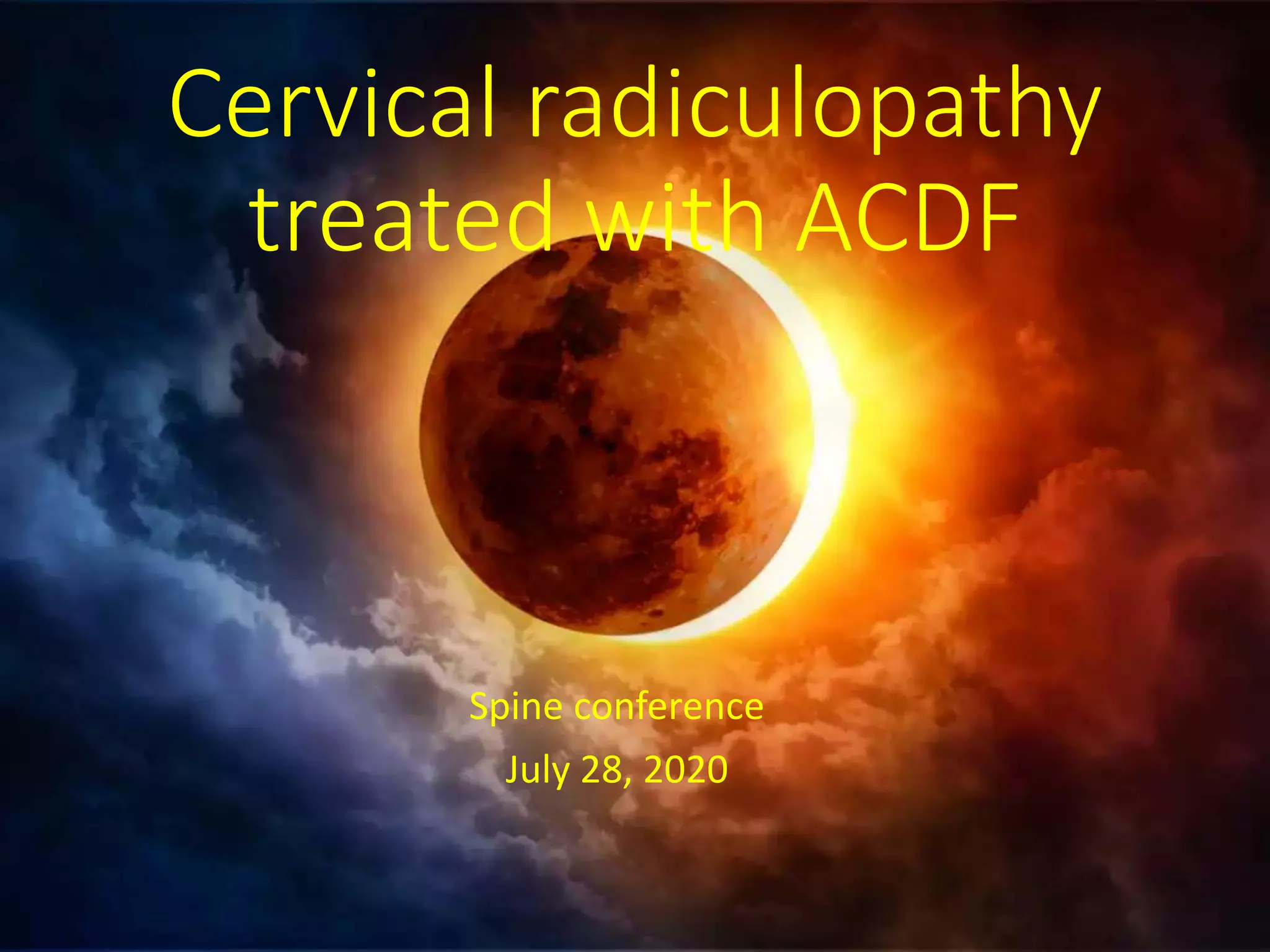 spine lecture cervical radiculopathy | PPT