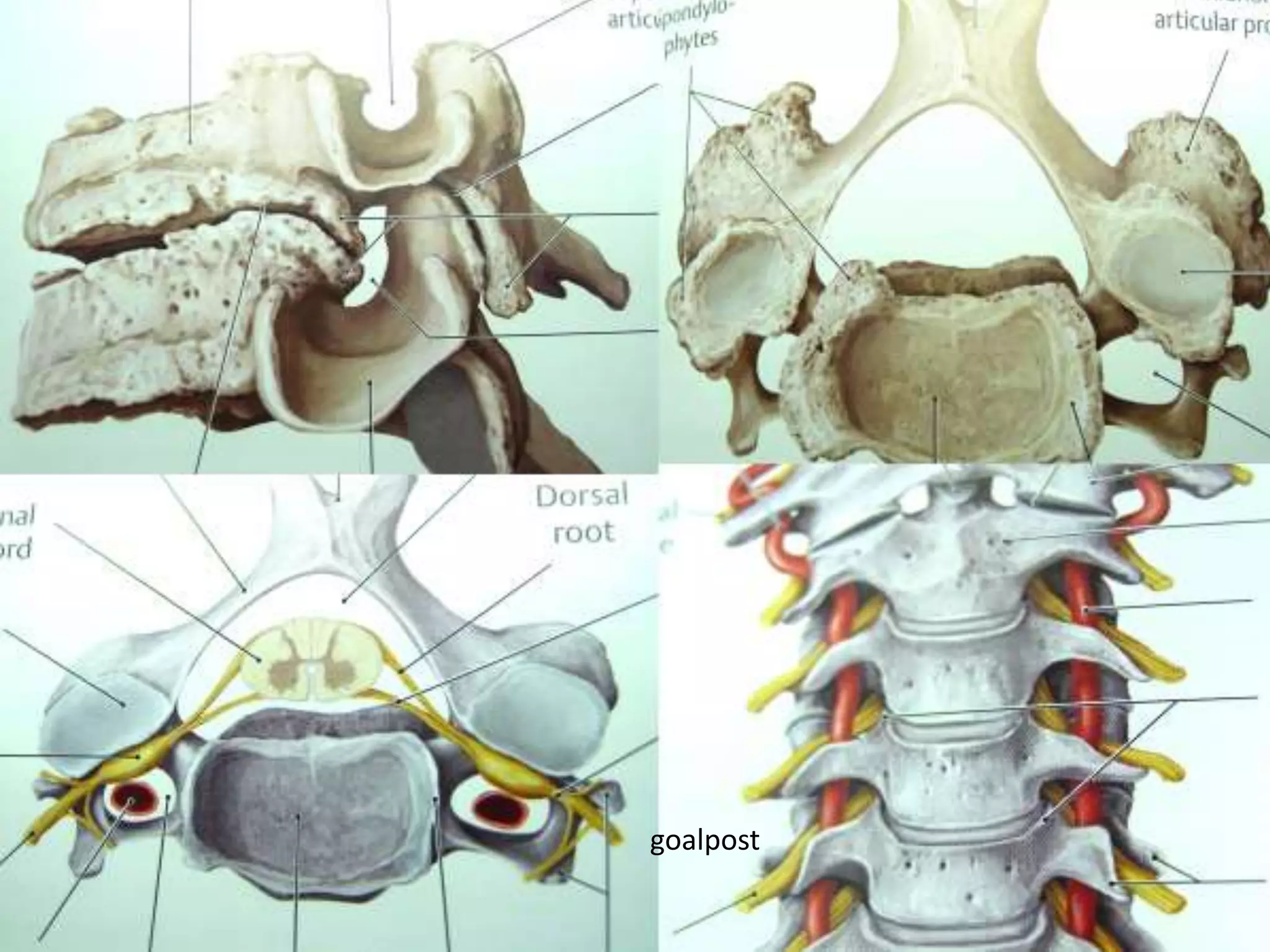 spine lecture cervical radiculopathy | PPT | Free Download