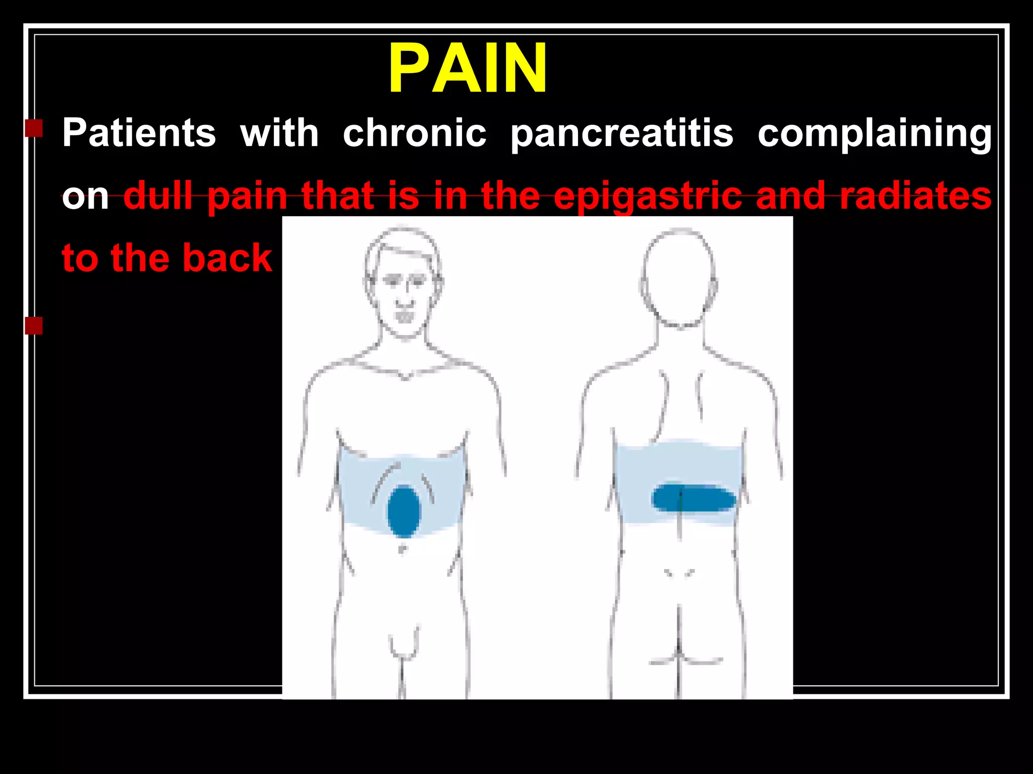 Lecture chronic pancreatitis | PPT