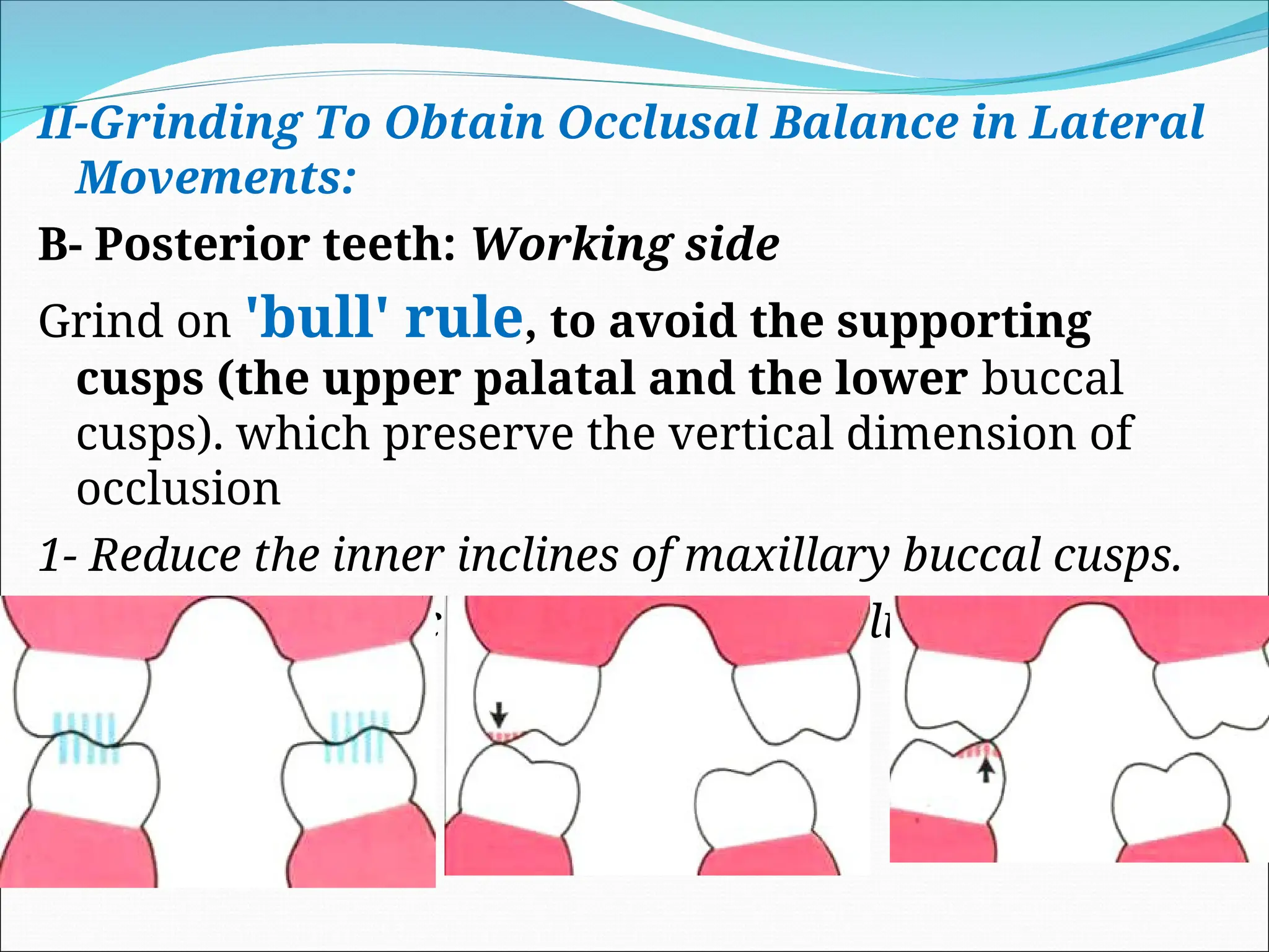 lecture denture insertion - dif Copy.ppt