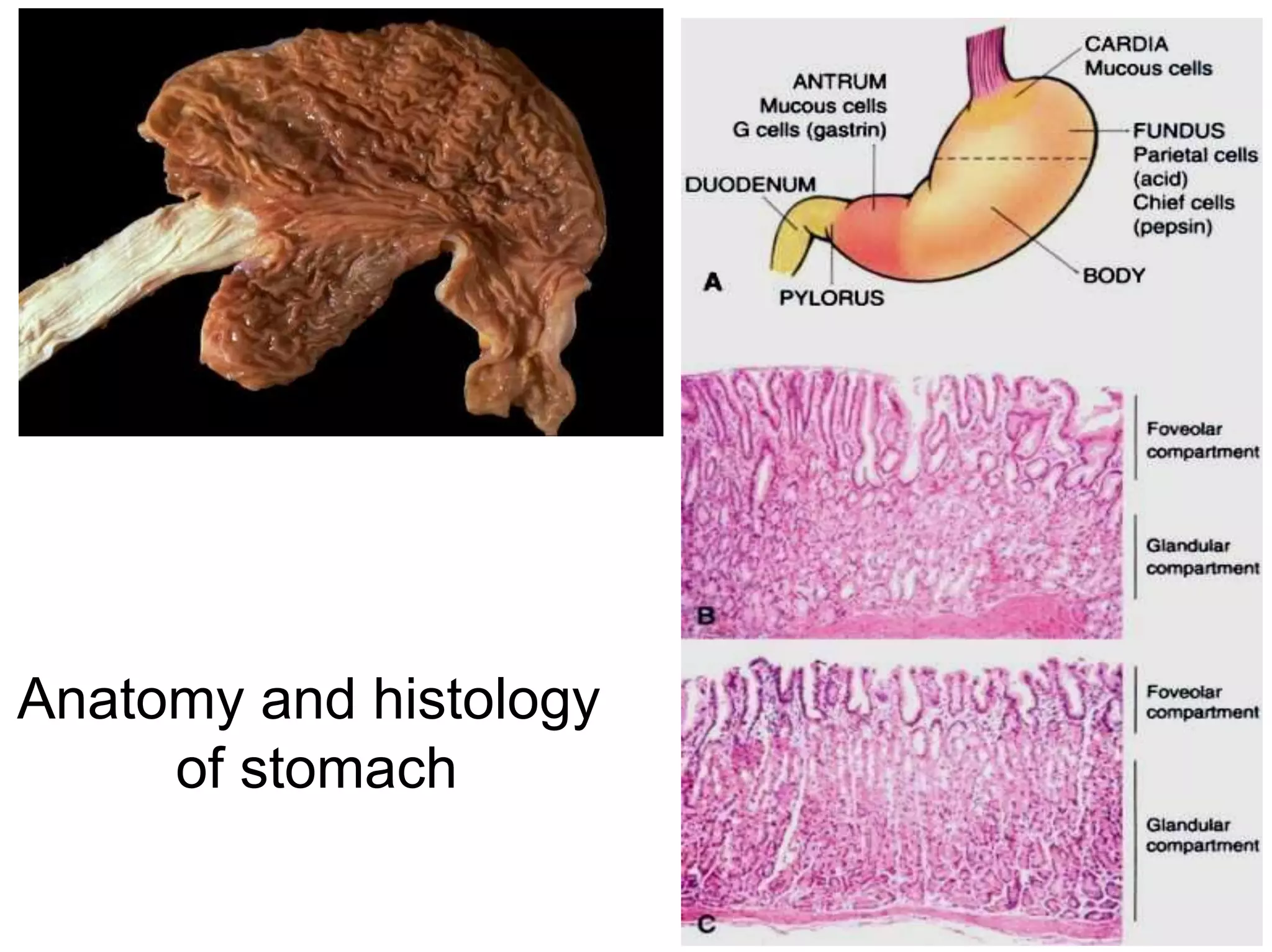 Lecture diseases of the git | PPT