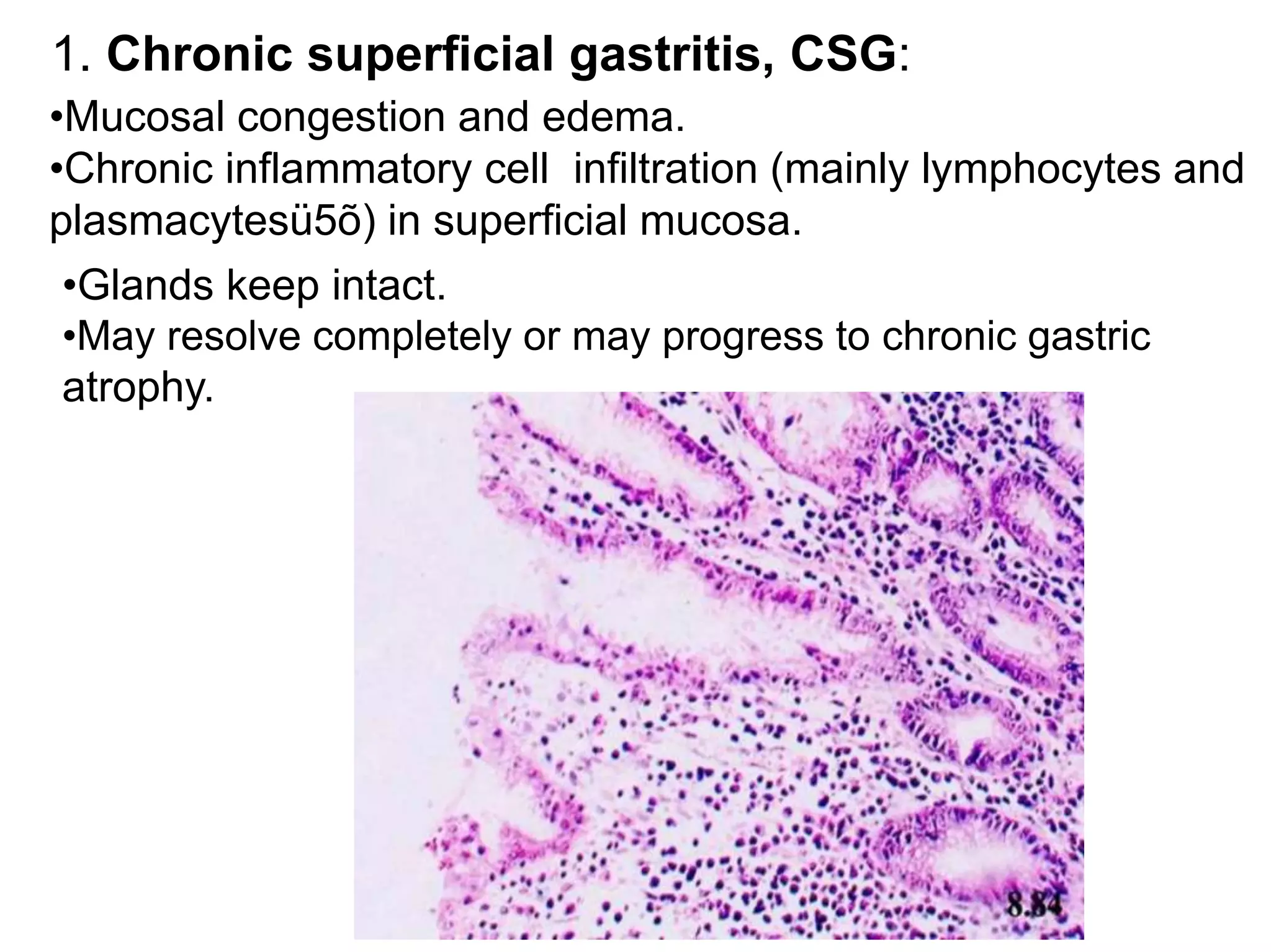 Lecture diseases of the git | PPT