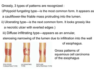 Lecture diseases of the git | PPT