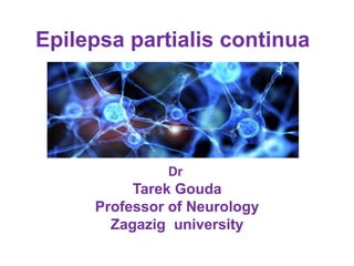 Epilepsa partial continua | PPTX