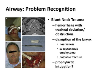 First Aid in Chest Injuries | PDF