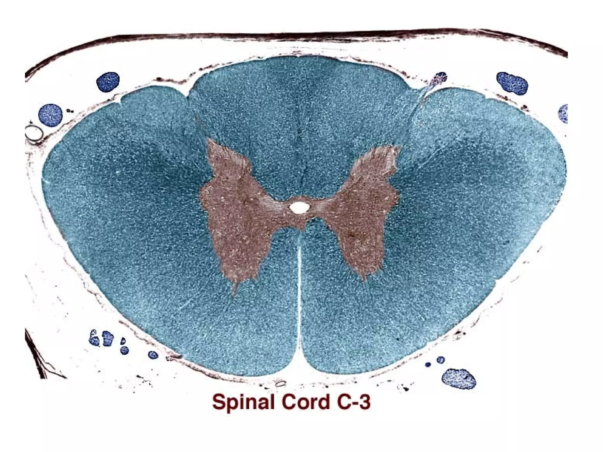 Lecture fourteen neuroanatomy, Embryology of the CNS.pdf