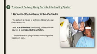 lecture HDR LDR brachytherapy.pdfxjxusuhsjsjsj | PPT