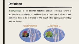 Shsusu lecture HDR LDR brachytherapy 2.pdf