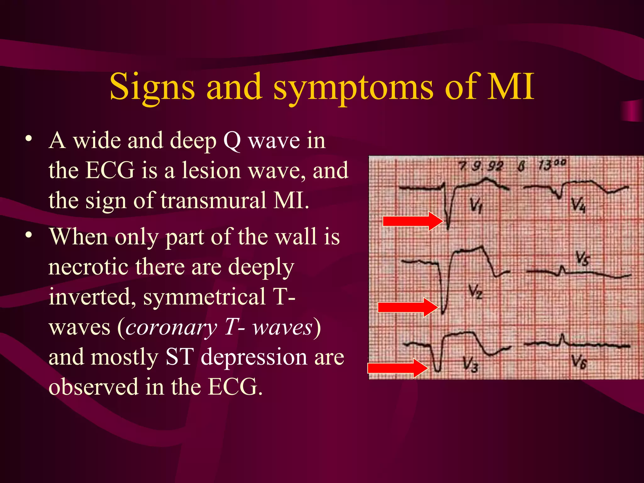 Heart pathology | PPT