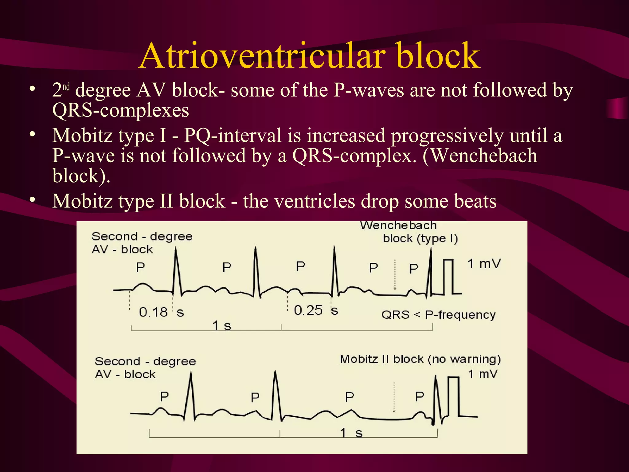 Heart pathology | PPT