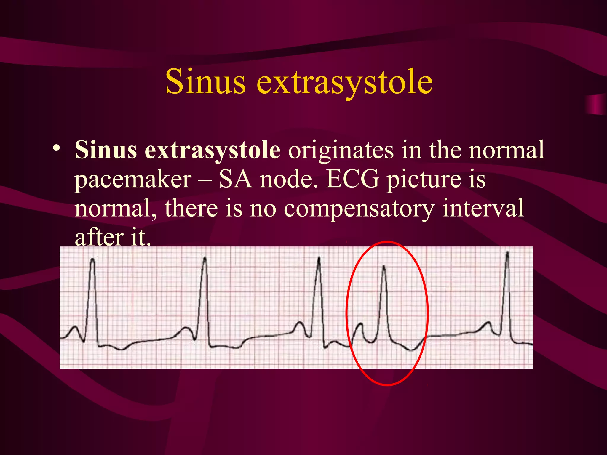 Heart pathology | PPT