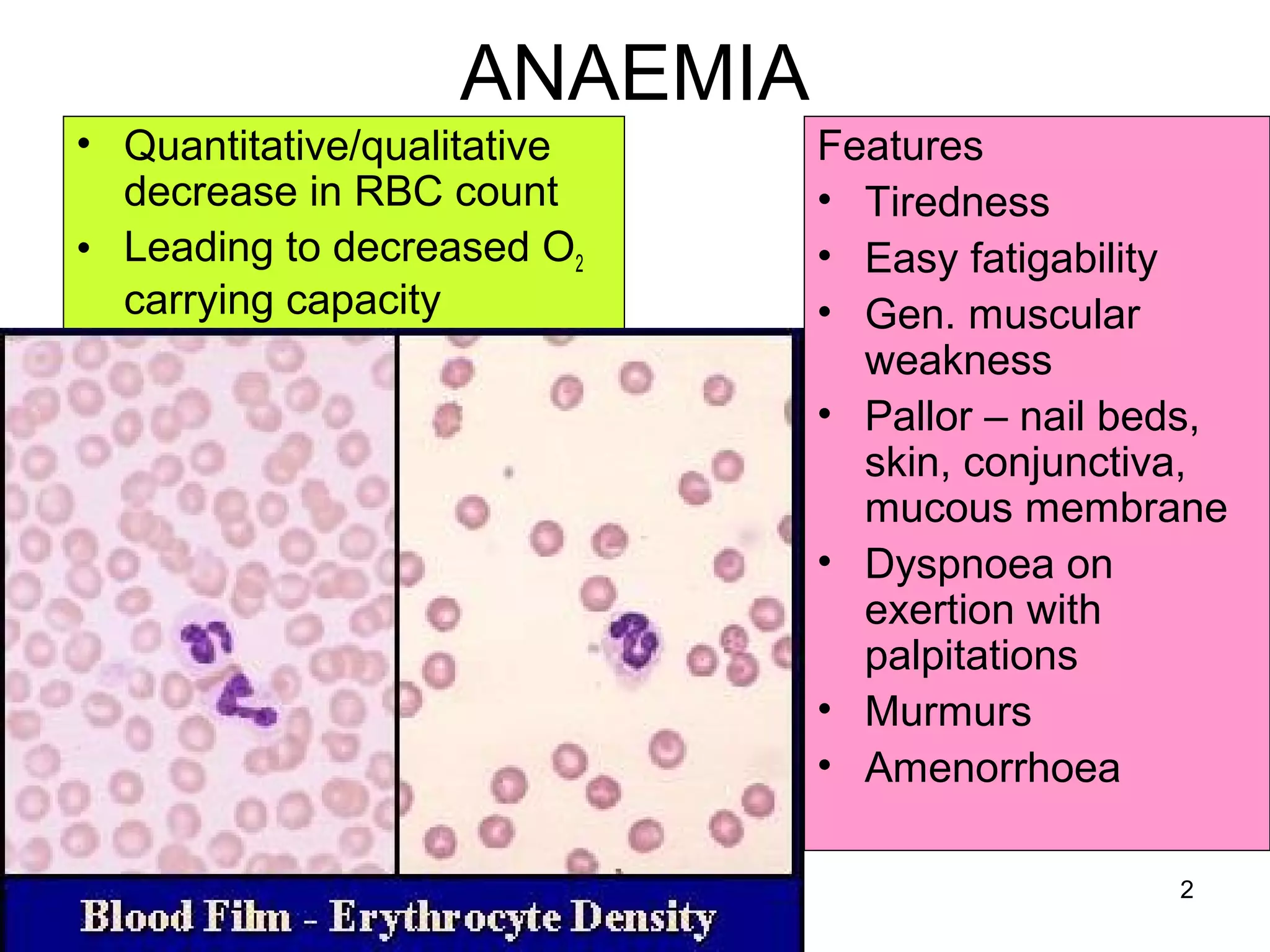 Lecture iii anaemia | PPT