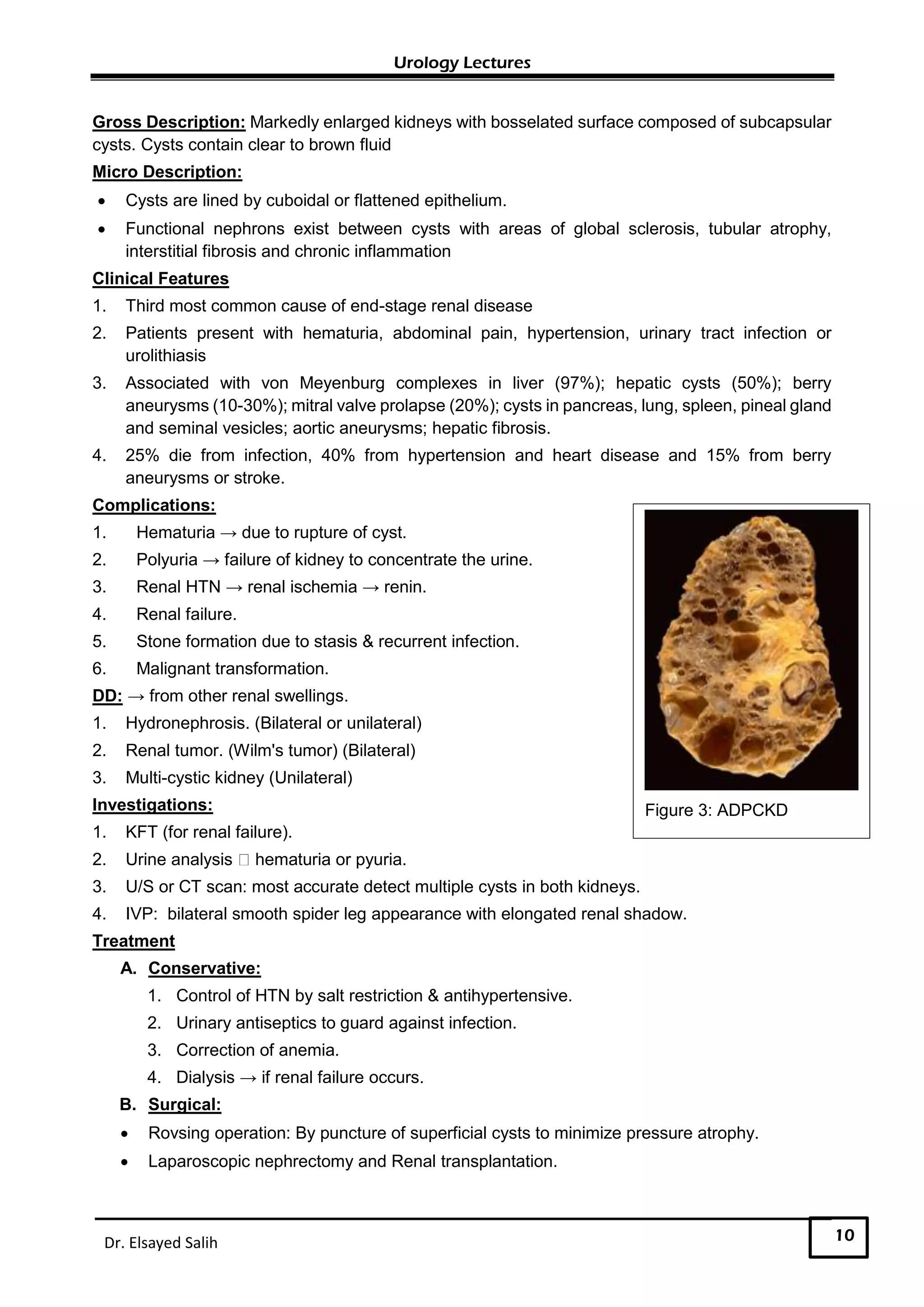 Lectures in urology for undergraduate medical students | PDF