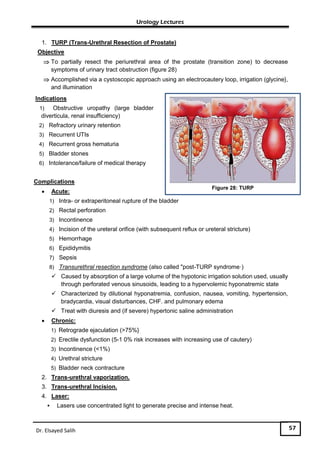 Lectures in urology for undergraduate medical students | PDF