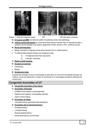 Lectures in urology for undergraduate medical students | PDF