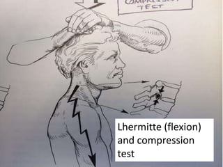 Posterior cervical laminoplasty for stenosis | PPTX
