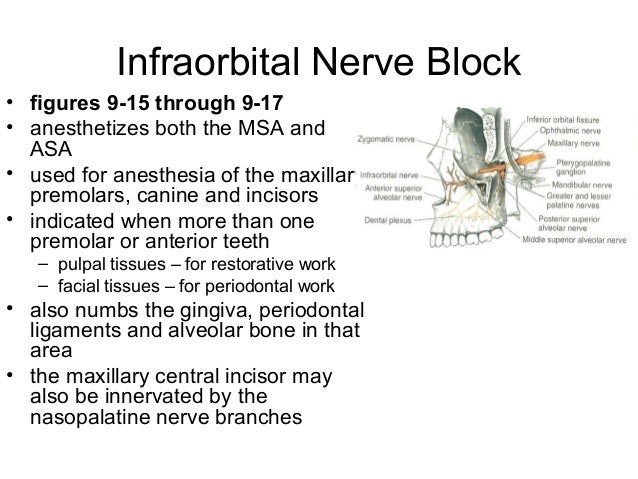 Lecture localanesthesia