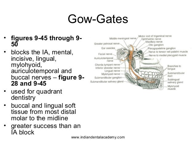 Dental Anesthesia Gowgates Mandibular Nerve Block An Gow Gates.flv