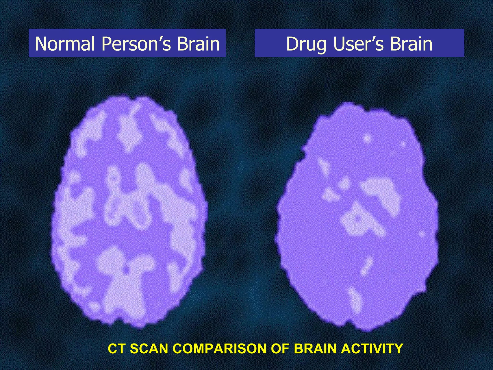 PDEA Lecturematerial | PPT