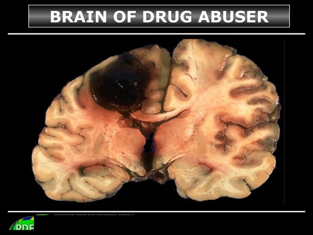 PDEA Lecturematerial | PPT