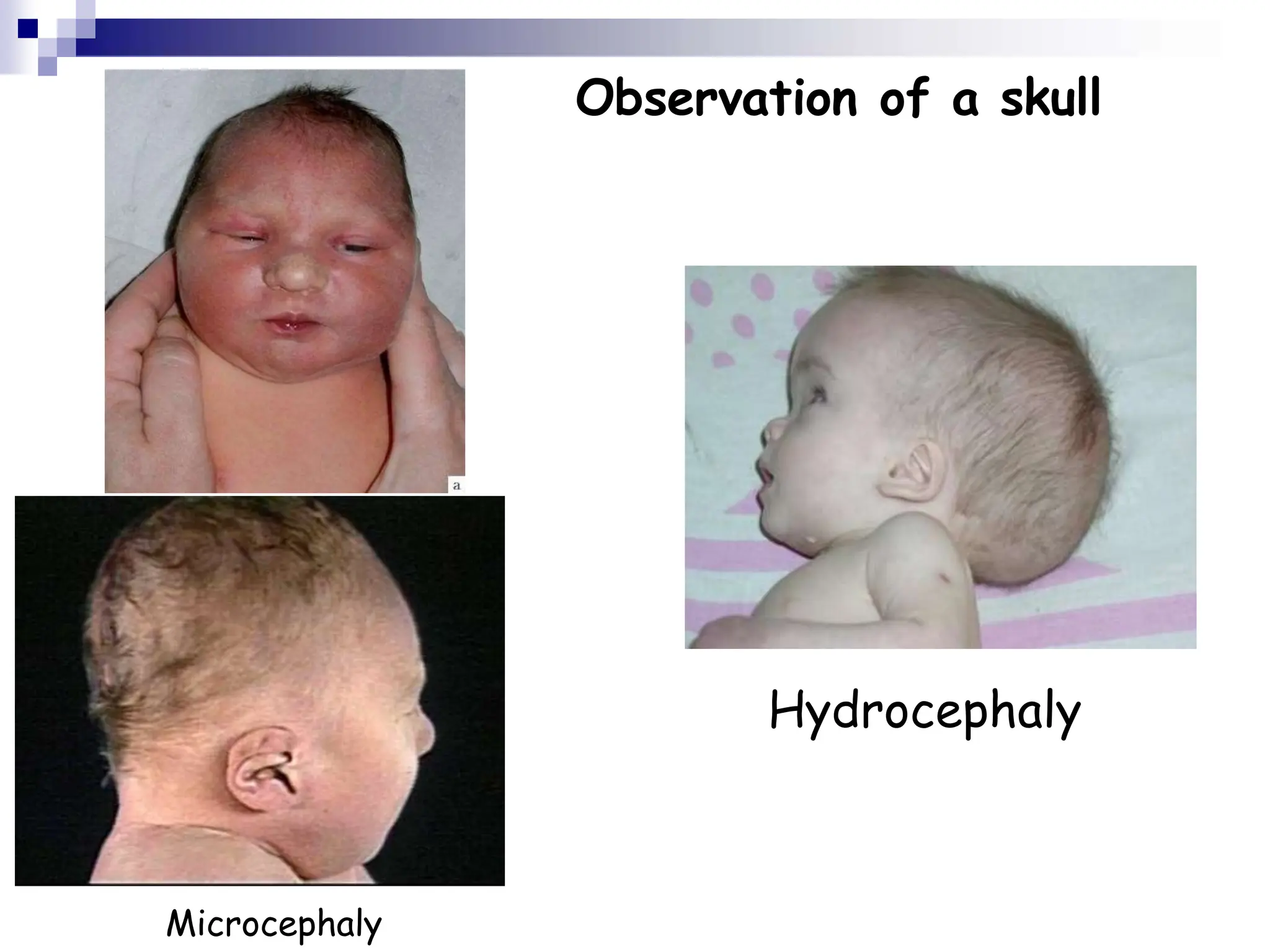 Lecture Musculoskeletal system in children.pptx