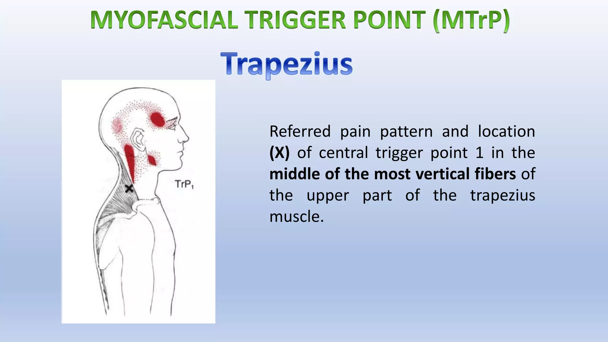 Trigger and tender points.pptx | First Aid | Injuries