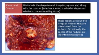 Introduction to Pathology and how to describe a Lesion | PDF