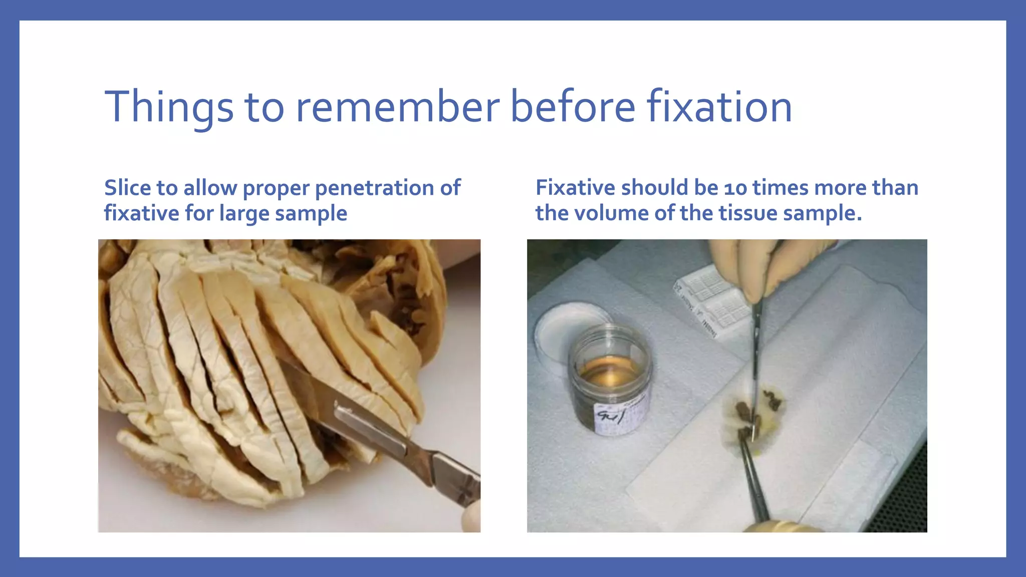 Histopathology , Sample collection to Wax infiltration (Tissue ...