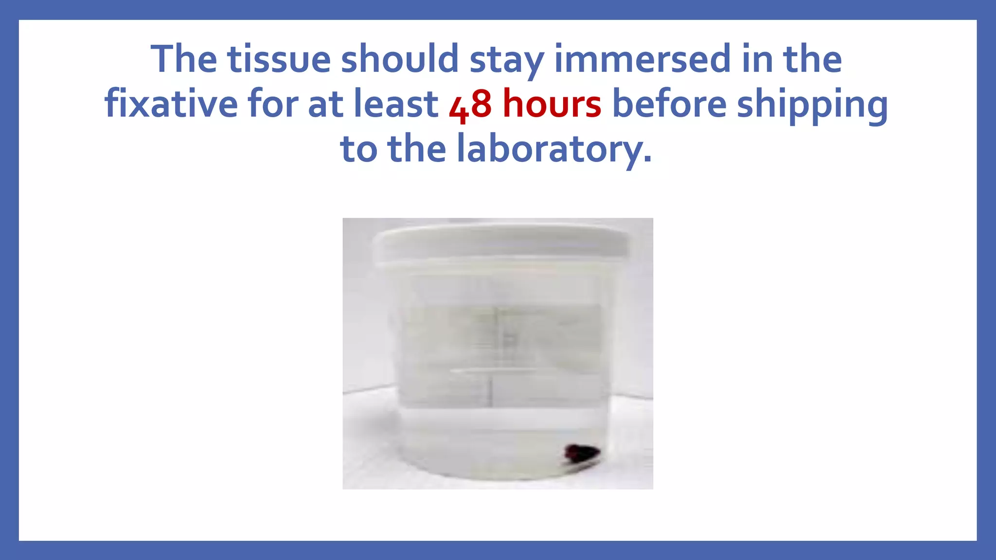 Histopathology , Sample collection to Wax infiltration (Tissue ...