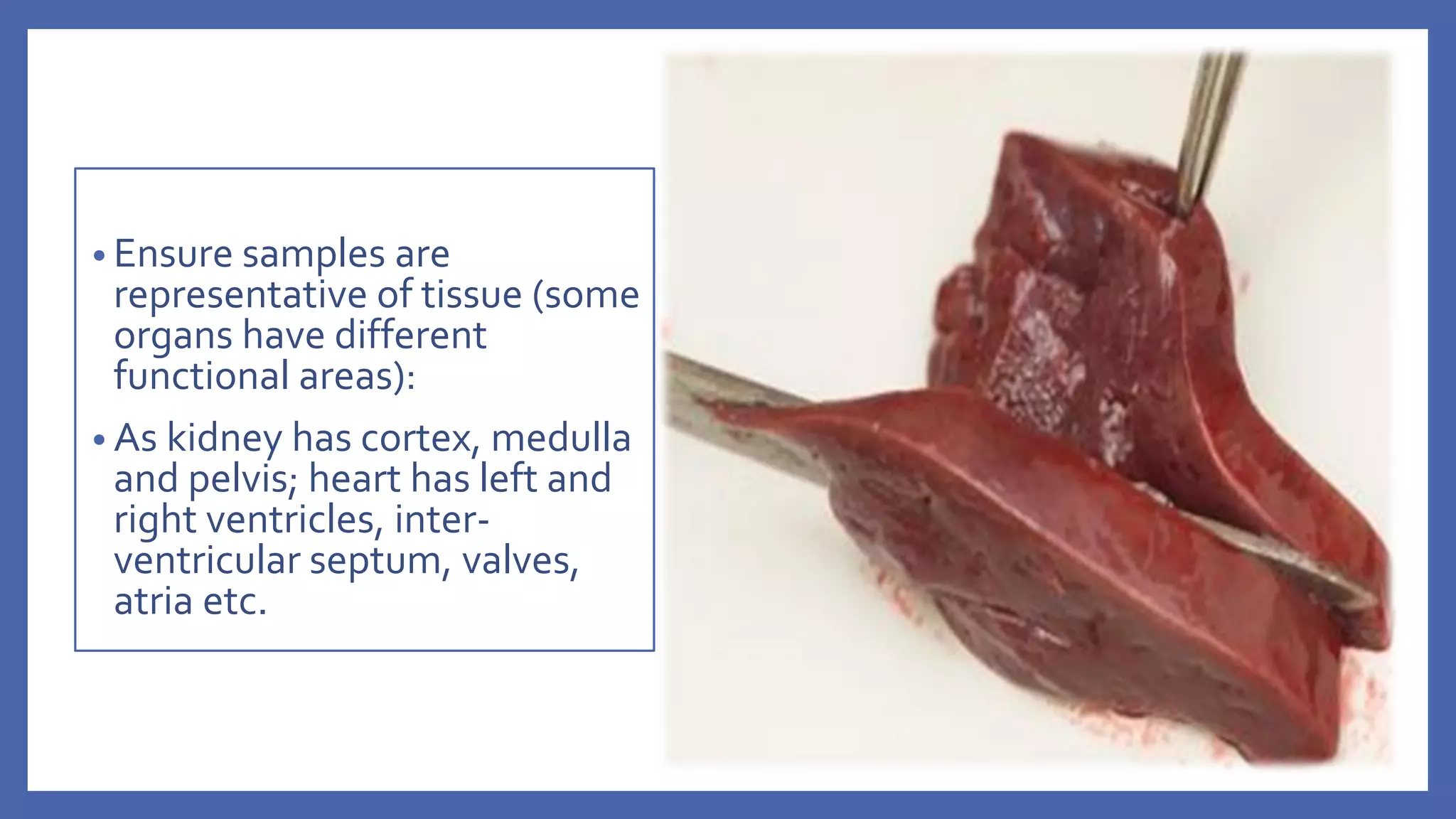 Histopathology , Sample collection to Wax infiltration (Tissue ...