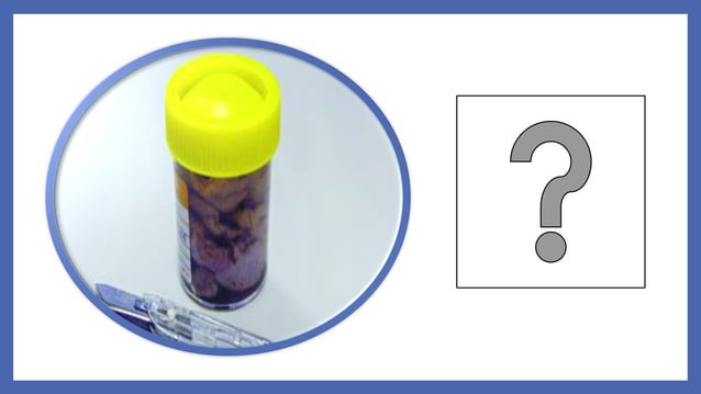 Histopathology , Sample collection to Wax infiltration (Tissue ...