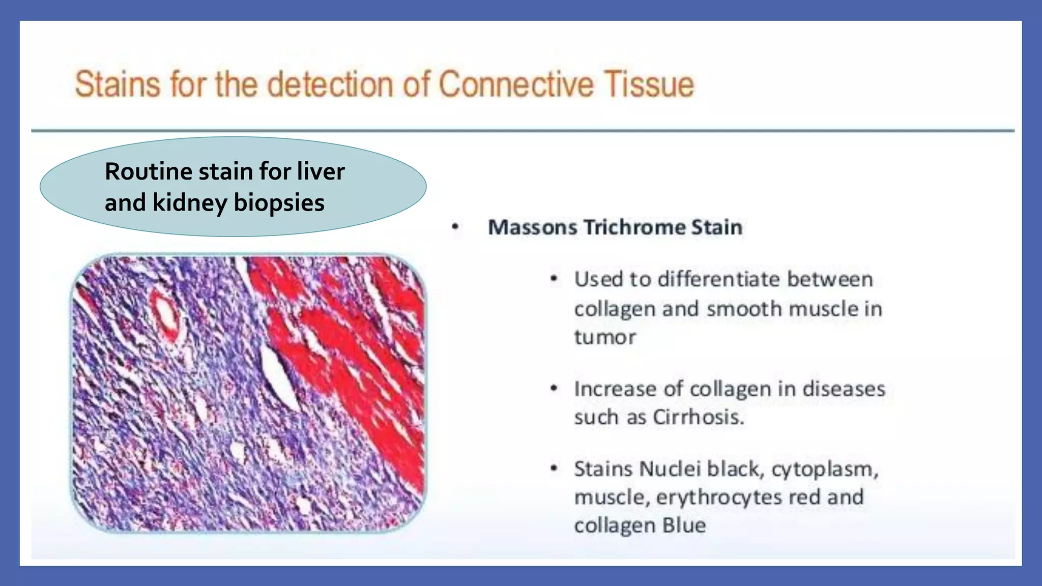 Special Stains used in Histopathology and Biopsy | PDF
