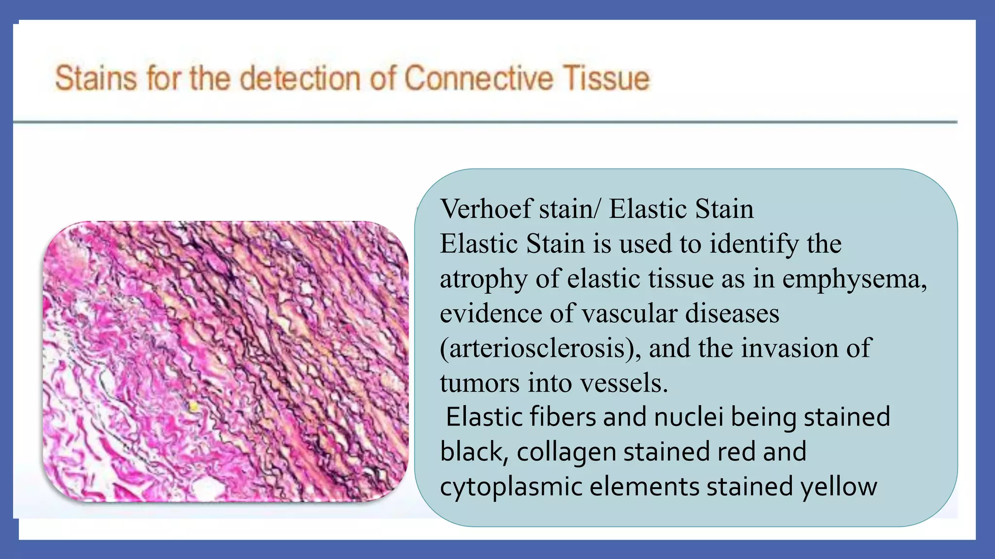 Special Stains used in Histopathology and Biopsy | PDF