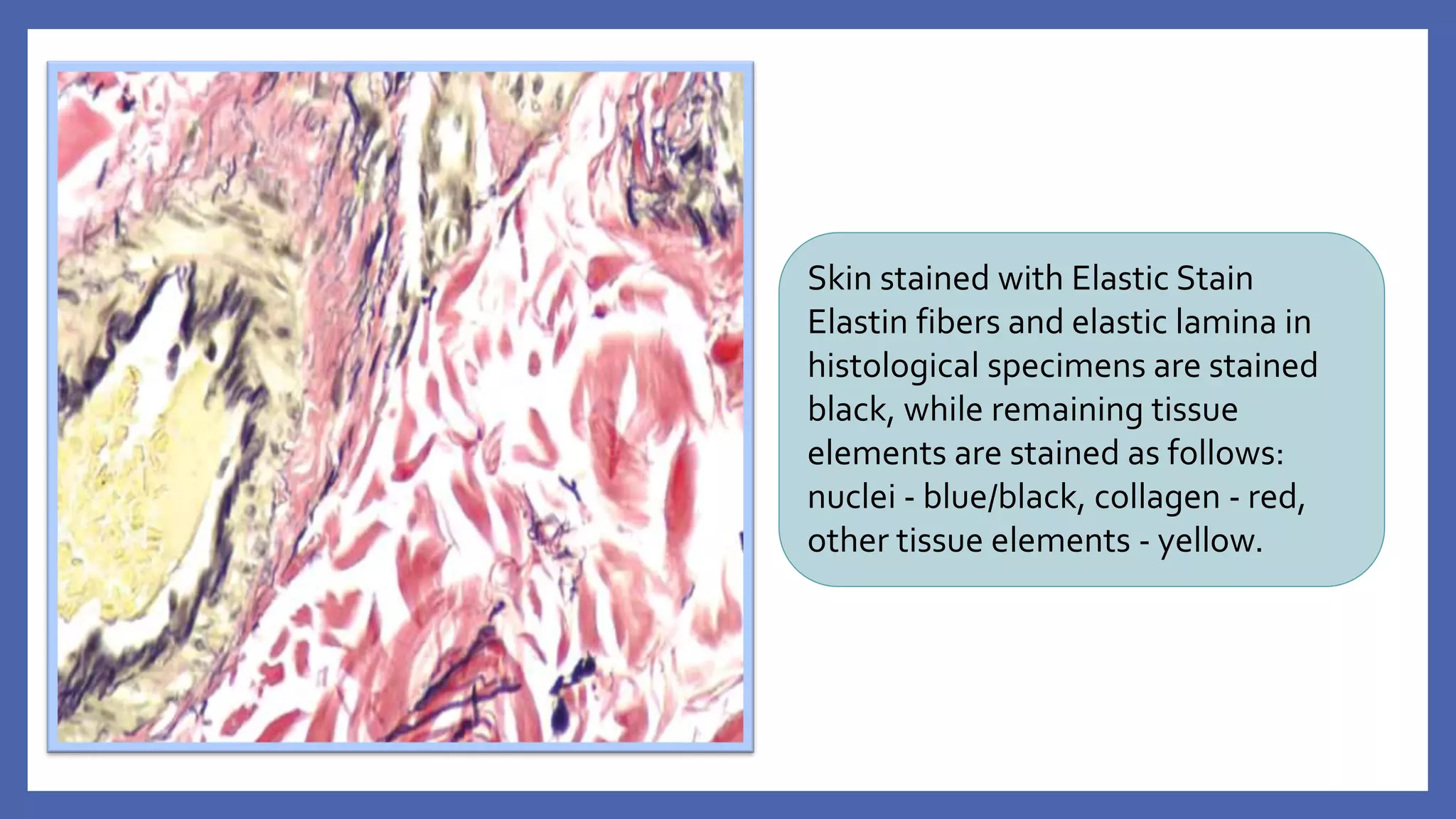 Special Stains used in Histopathology and Biopsy | PDF