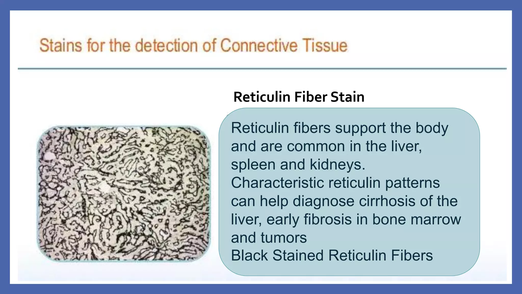 Special Stains used in Histopathology and Biopsy | PDF