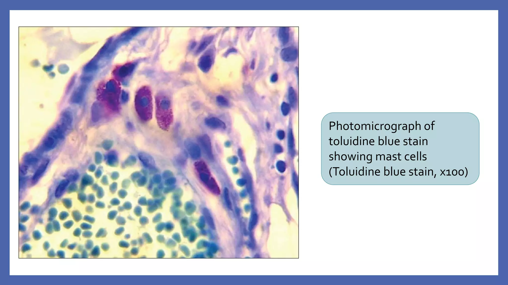 Special Stains used in Histopathology and Biopsy | PDF