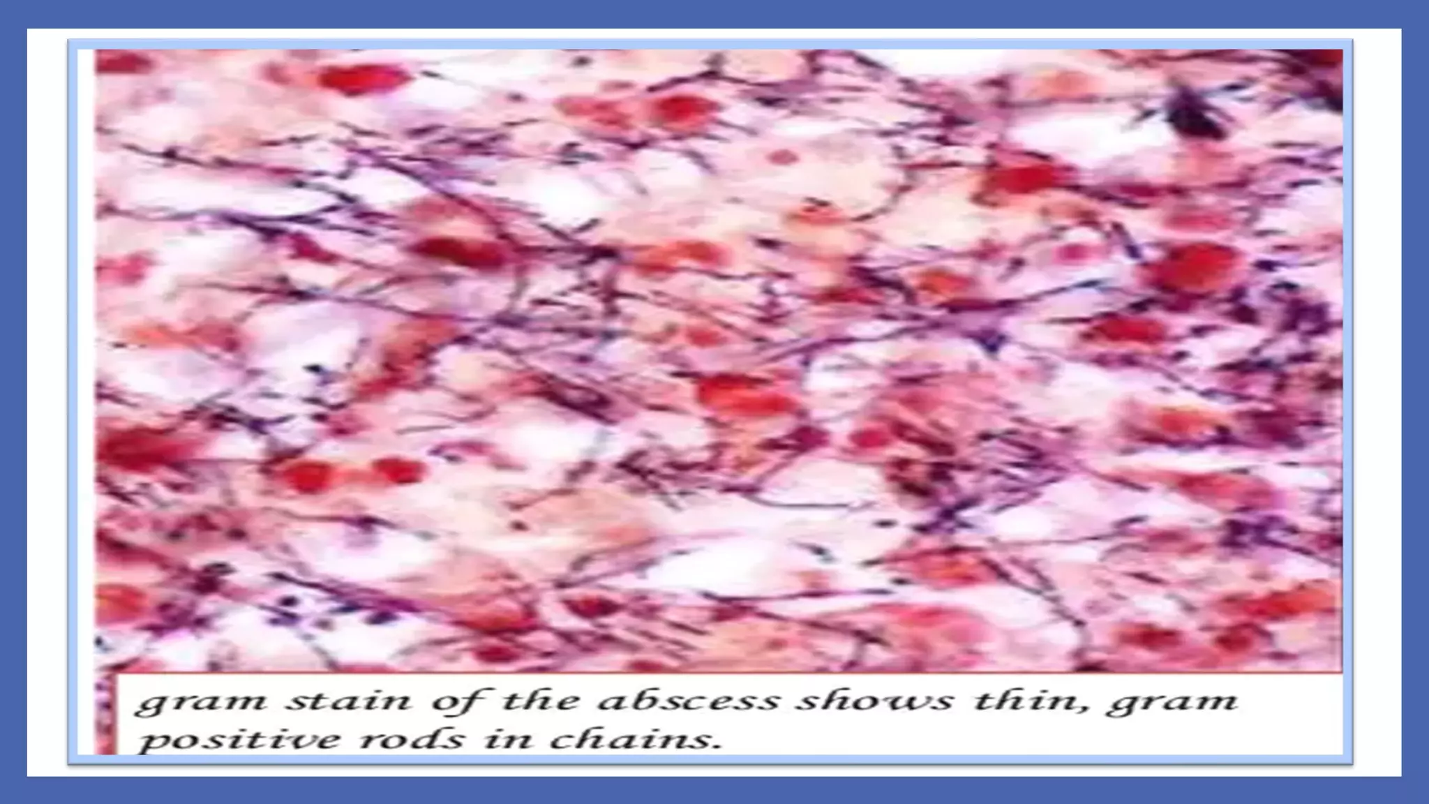 Special Stains used in Histopathology and Biopsy | PDF