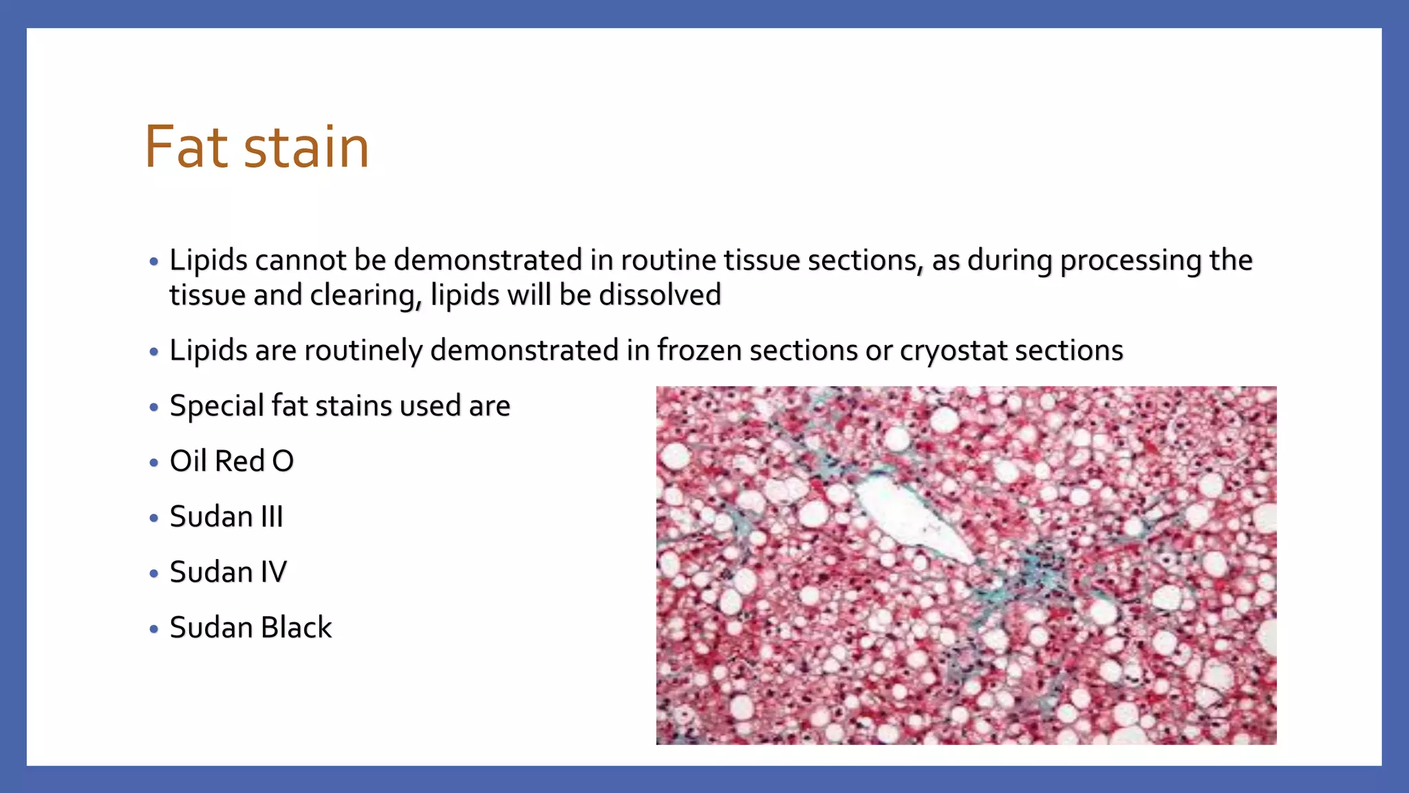 Special Stains used in Histopathology and Biopsy | PDF