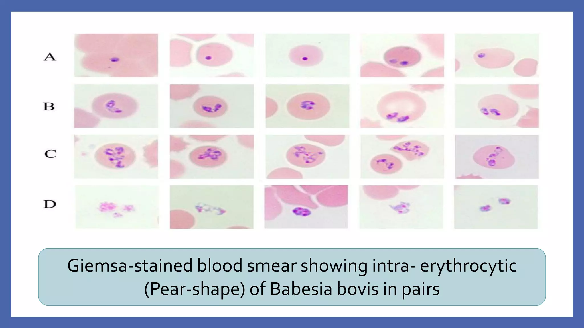 Special Stains used in Histopathology and Biopsy | PDF