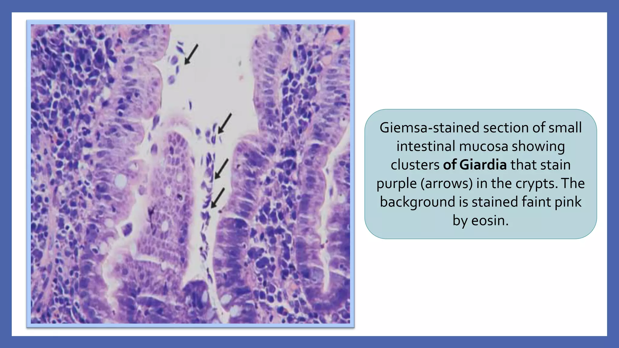 Special Stains used in Histopathology and Biopsy | PDF