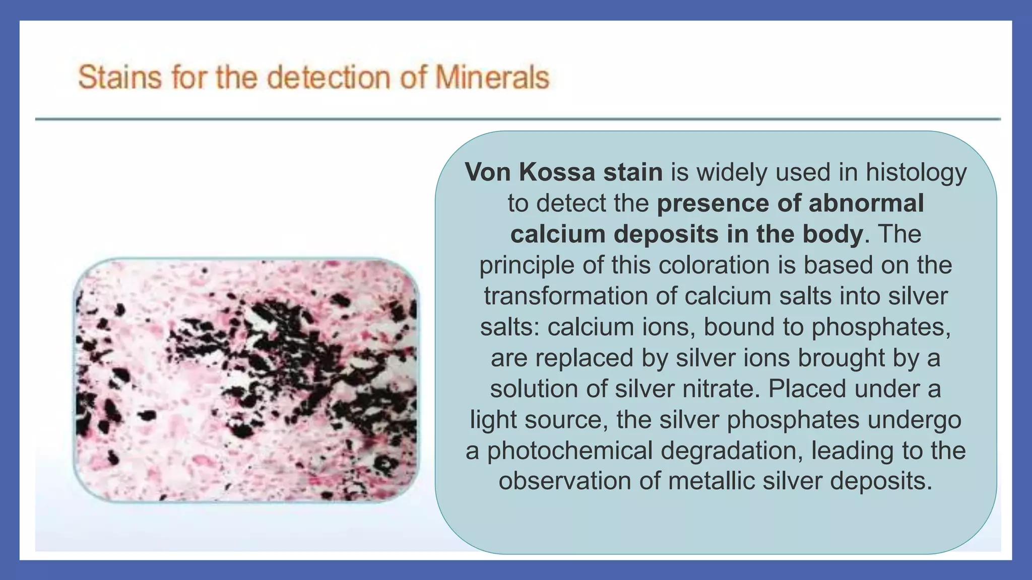 Special Stains used in Histopathology and Biopsy | PDF