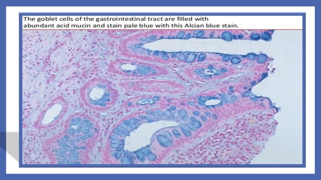 Special Stains used in Histopathology and Biopsy | PDF