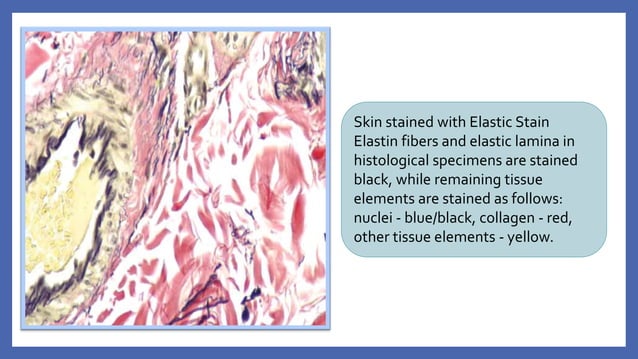 Special Stains used in Histopathology and Biopsy | PDF