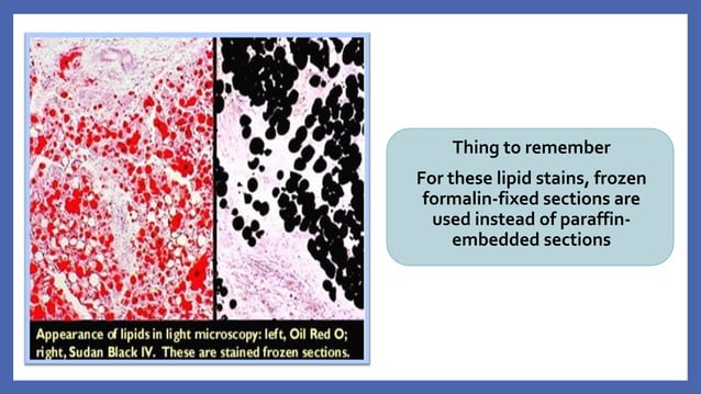 Special Stains used in Histopathology and Biopsy | PDF