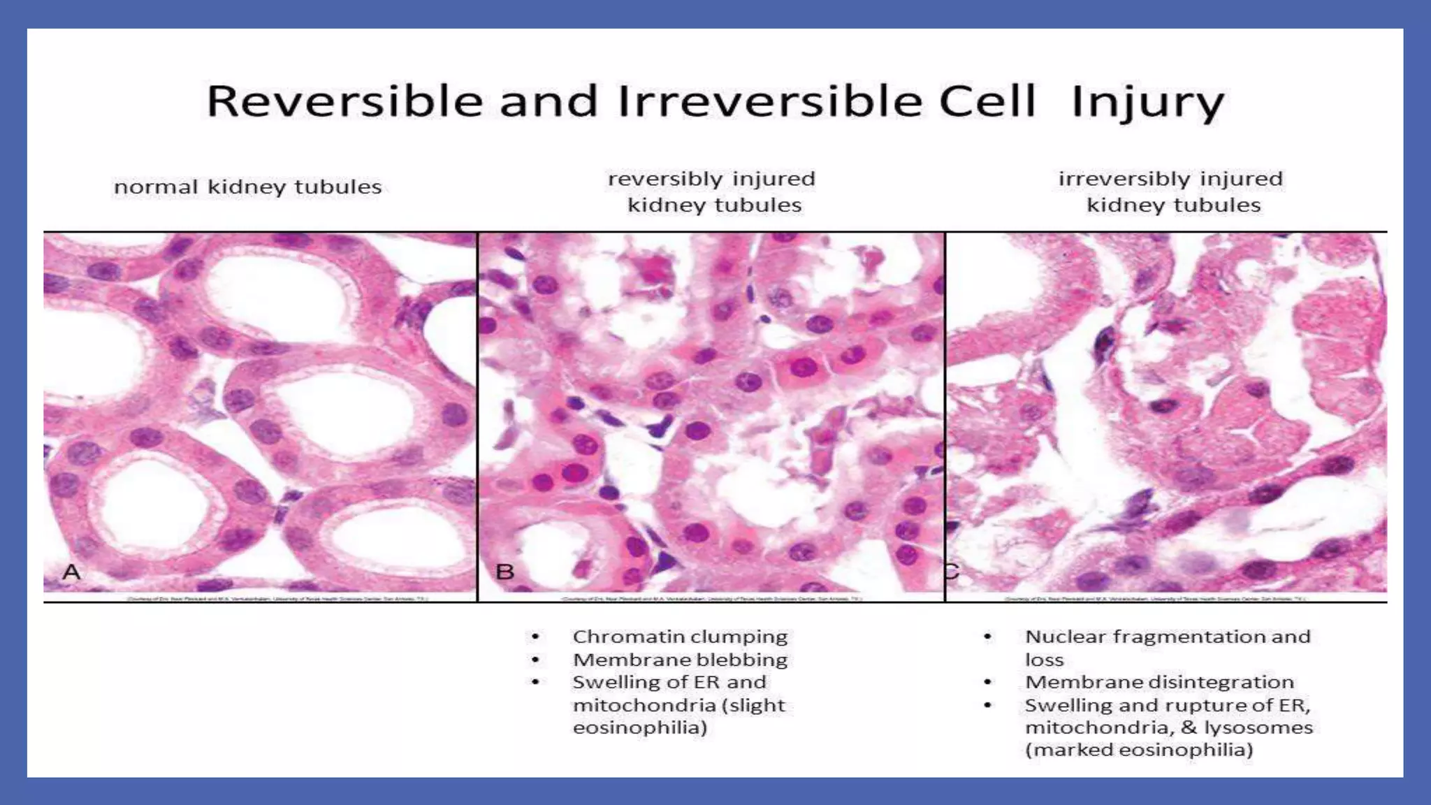 Difference between reversible and irreversible cell injury,Mechanism of ...