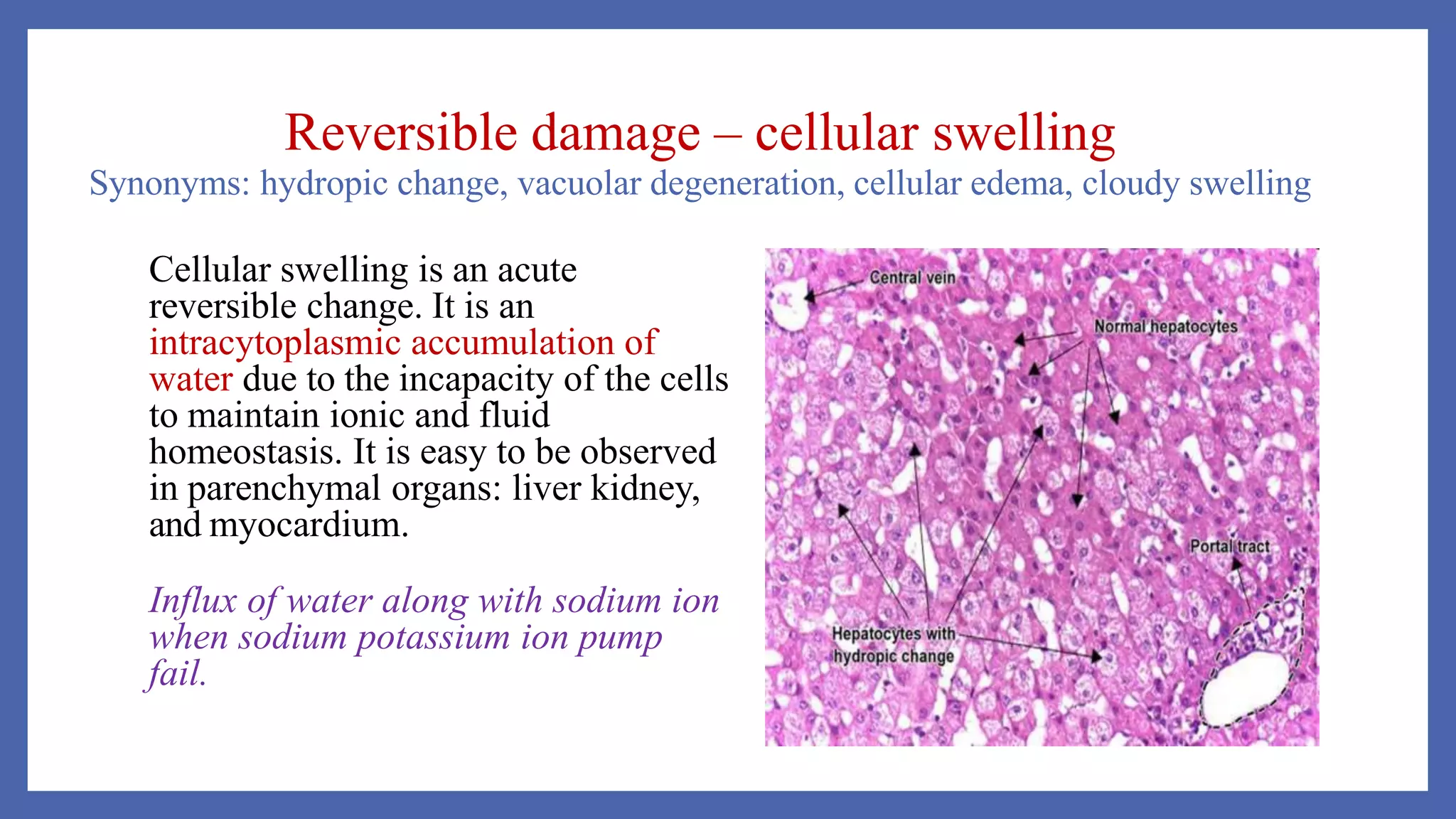 Difference between reversible and irreversible cell injury,Mechanism of ...