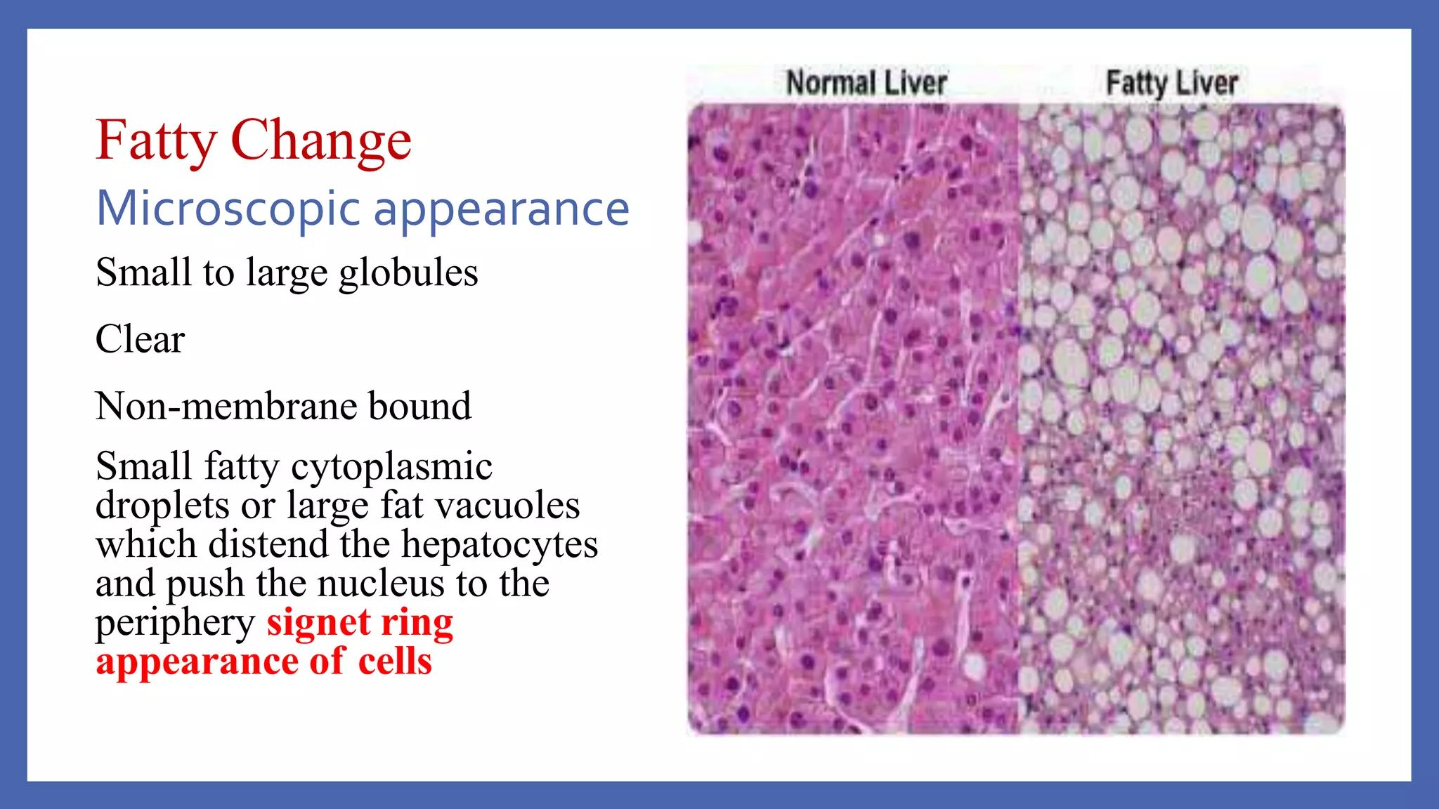 Difference between reversible and irreversible cell injury,Mechanism of ...