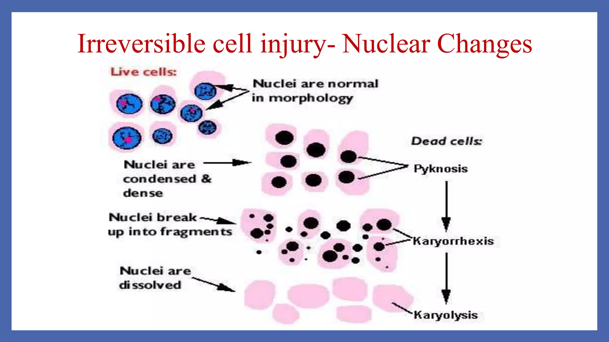 Difference between reversible and irreversible cell injury,Mechanism of ...