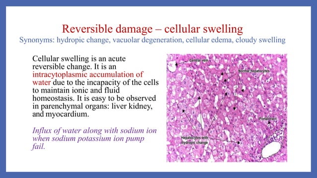 Difference between reversible and irreversible cell injury,Mechanism of ...